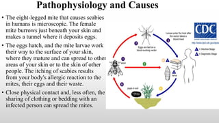 SCABIES BY DR MALZ.pptx