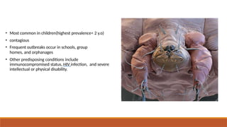 scabies by master doctor fadhly shariman.pptx