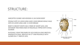 scabies by master doctor fadhly shariman.pptx
