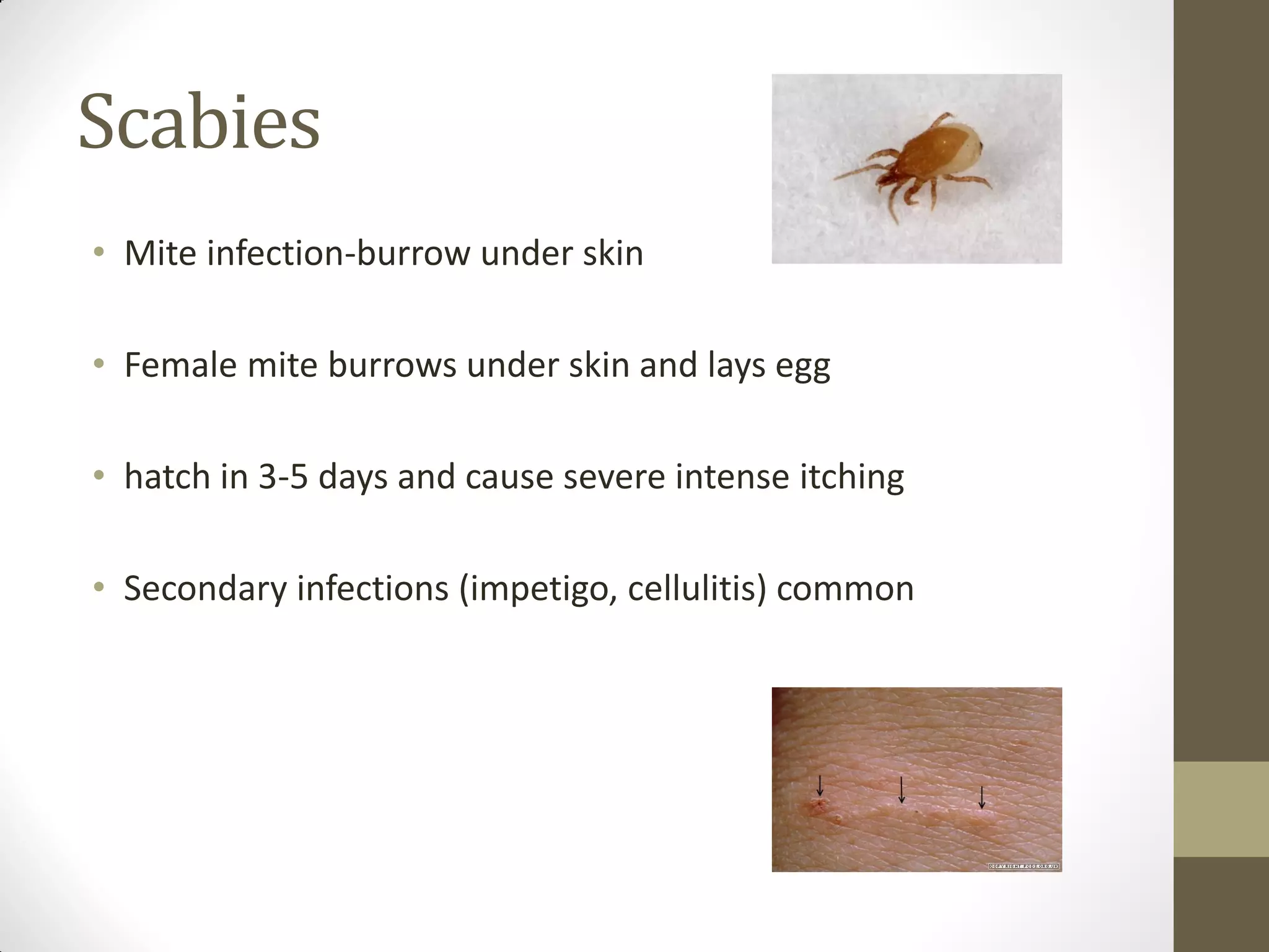 Scabies, cellulitis ihope ping | PDF