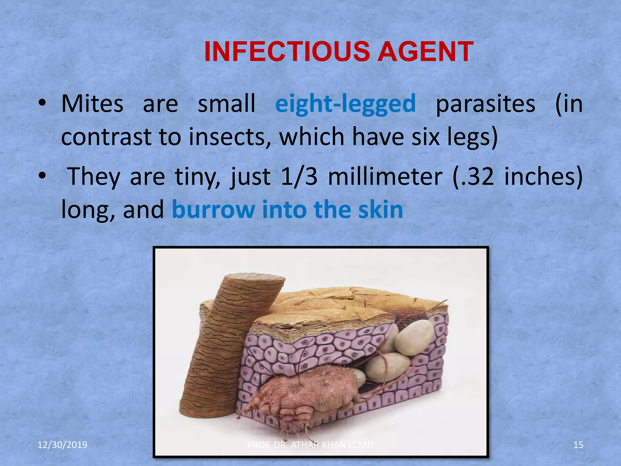 Scabies | PPT