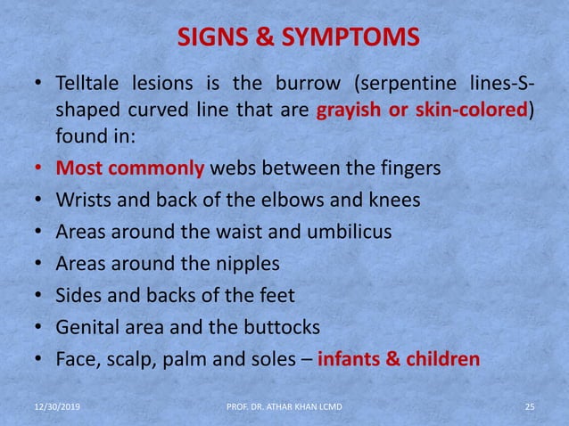 Scabies | PPT