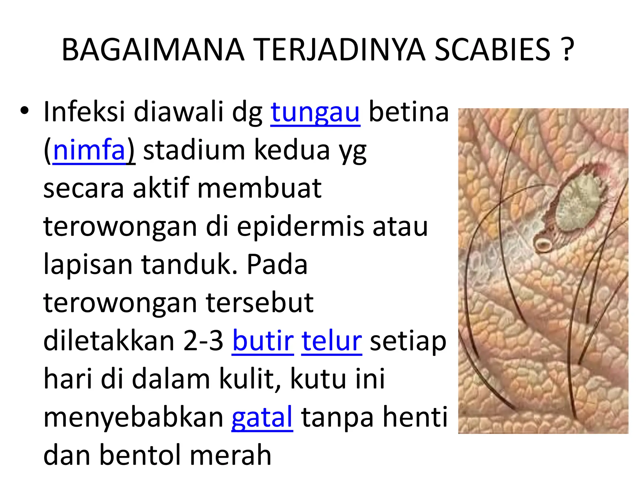 POWERPOINT TENTANG SCABIES (KUDIS/GUDIK).pptx