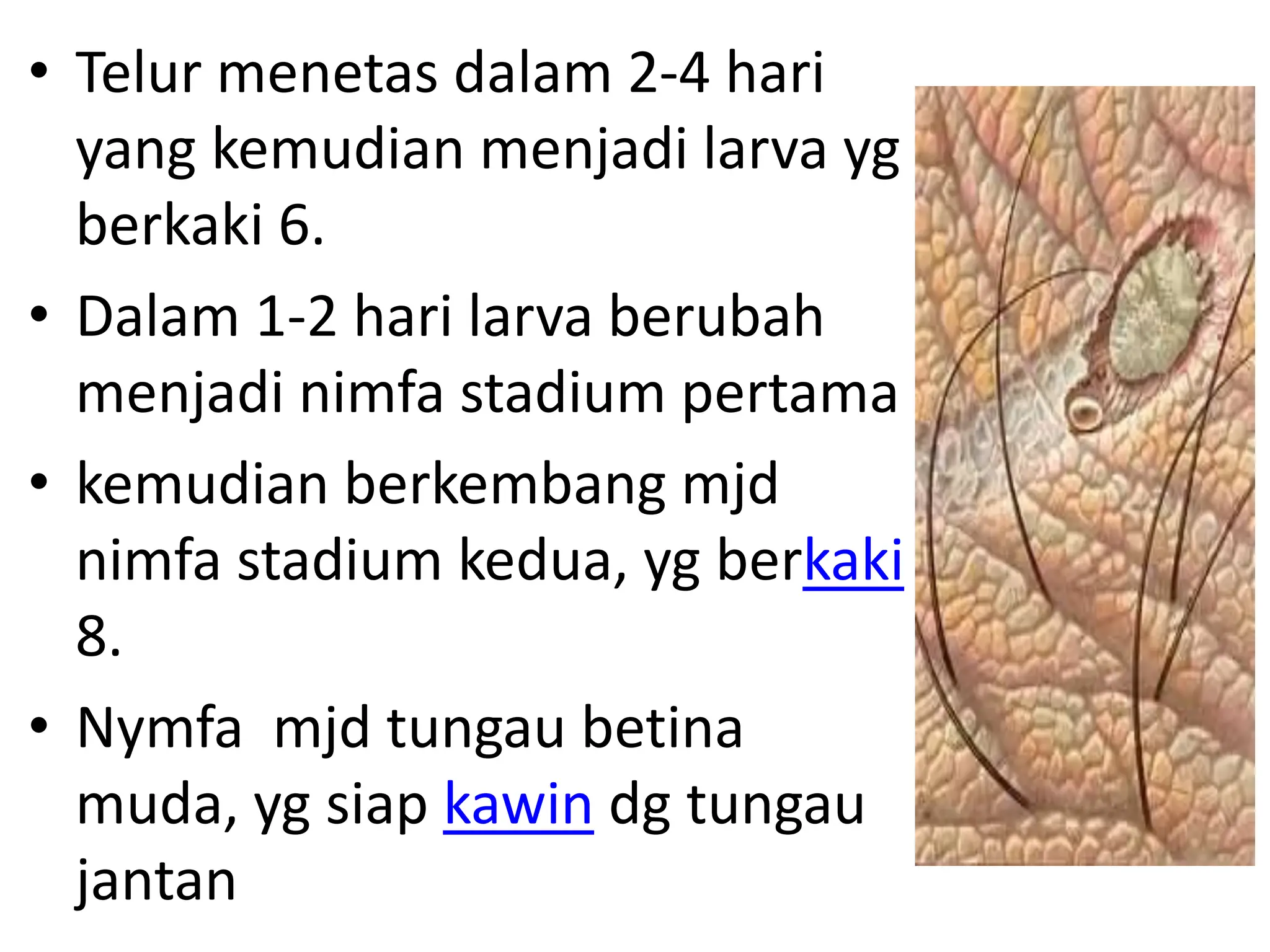 POWERPOINT TENTANG SCABIES (KUDIS/GUDIK).pptx