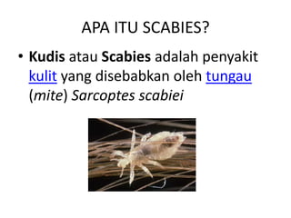 POWERPOINT TENTANG SCABIES (KUDIS/GUDIK).pptx