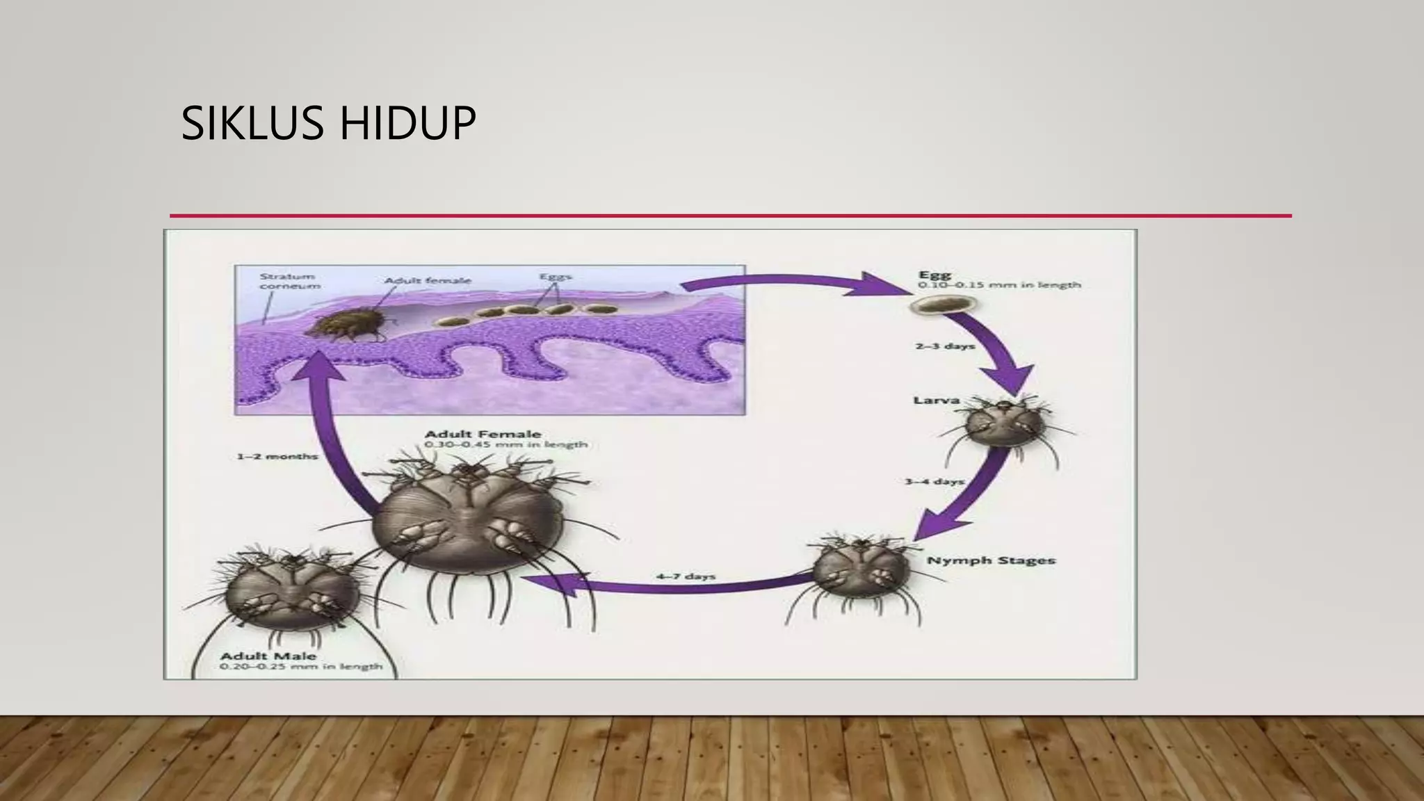 SCABIES IKE.pptx