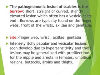 Scabies lecture.pptx
