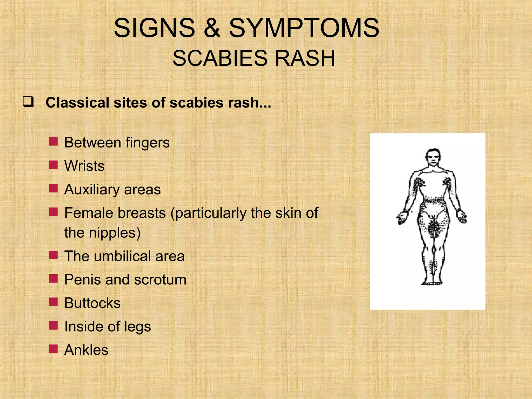 Scabies Life cycle, Diagnosis & Treatment | PPT