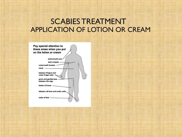 Scabies Life cycle, Diagnosis & Treatment | PPT