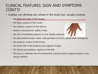 scabies notes_ppt.pptx