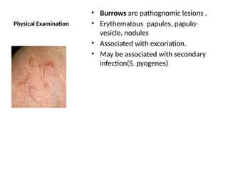 Scabies Pediculosis UG.pptxhvgvgvvvtvtvtvvtbtbtv | PPTX