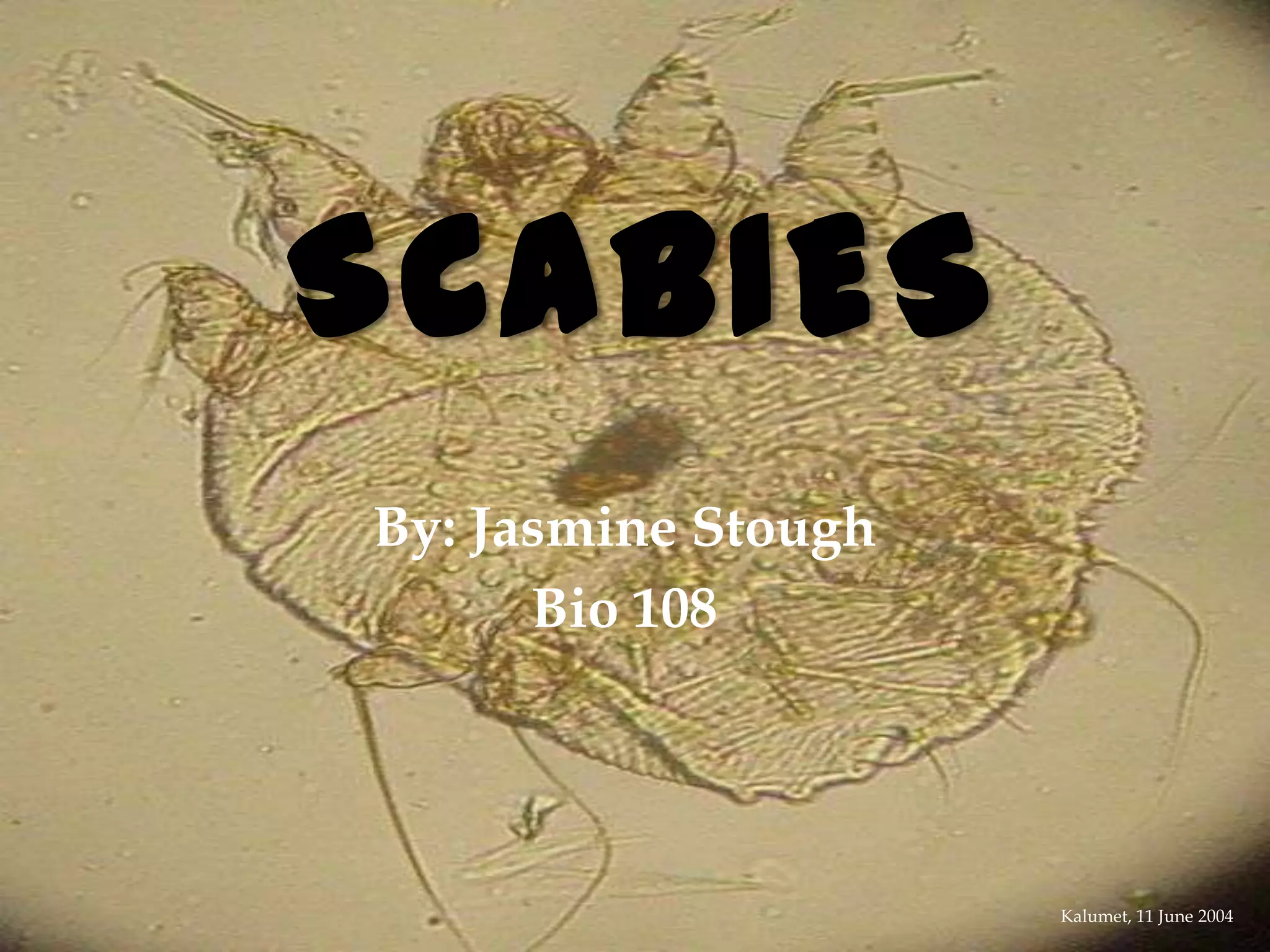 Scabies presentation 2 | PPTX | Infectious Diseases | Diseases and ...