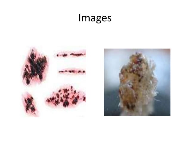 Scabs | PPTX