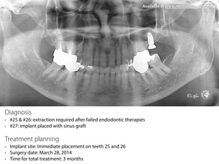 SCA Kit case(Neobiotech) | PPT