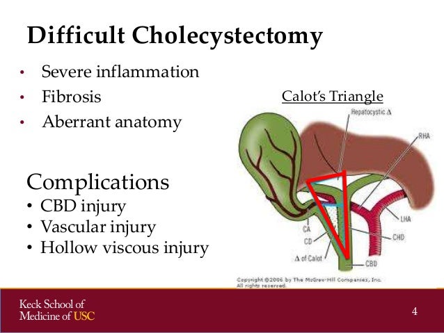 SoCal ACS 2014 - Subtotal Cholecystectomies