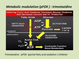 stable coronary artery disease | PPTX