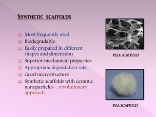 Scaffold engineering for bone reconstructive surgery | PDF