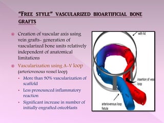 Scaffold engineering for bone reconstructive surgery | PDF