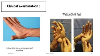 Scahpoid fracture and its physiotherapy management | PPTX