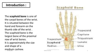 Scahpoid fracture and its physiotherapy management | PPTX