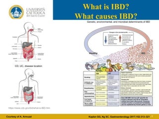Malattie infiammatorie intestinali | PPTX | Digestive Disorders ...