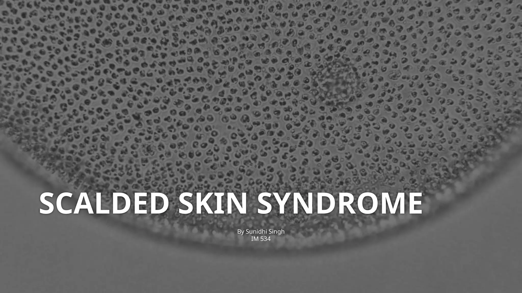 Scalded Skin Syndrome: Etiology, Clinical Presentation, Diagnosis ...