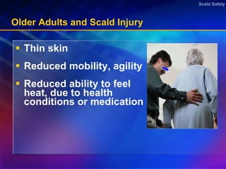 Scald injury powerpointpresentation | PPT