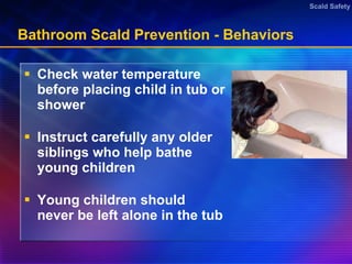 Scald injury powerpointpresentation | PPT