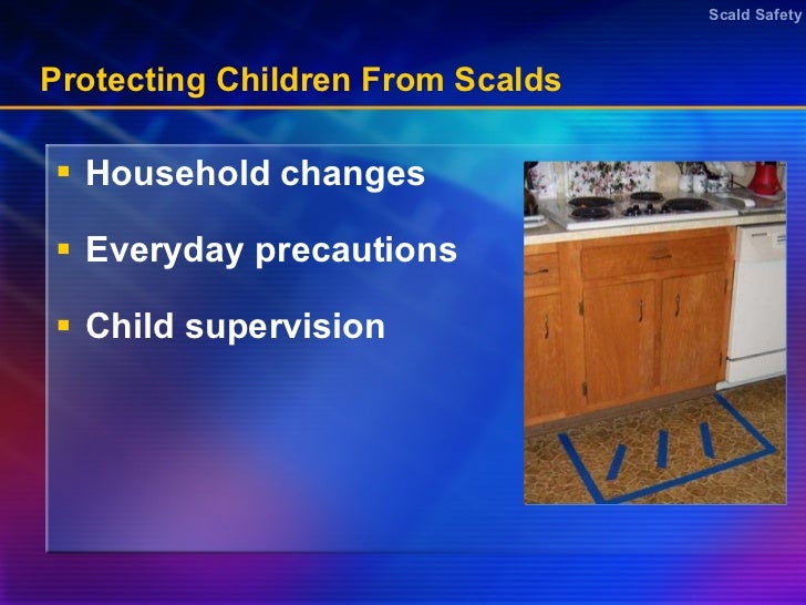 Scald injury powerpointpresentation