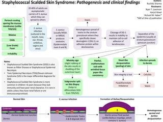 Scaled skin syndrome .pdf