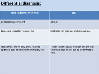Scaled skin syndrome .pdf