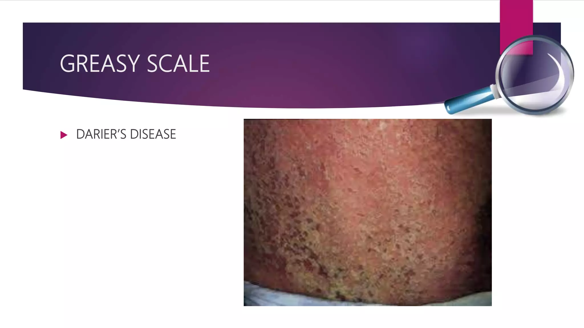 Types of scales.pptx