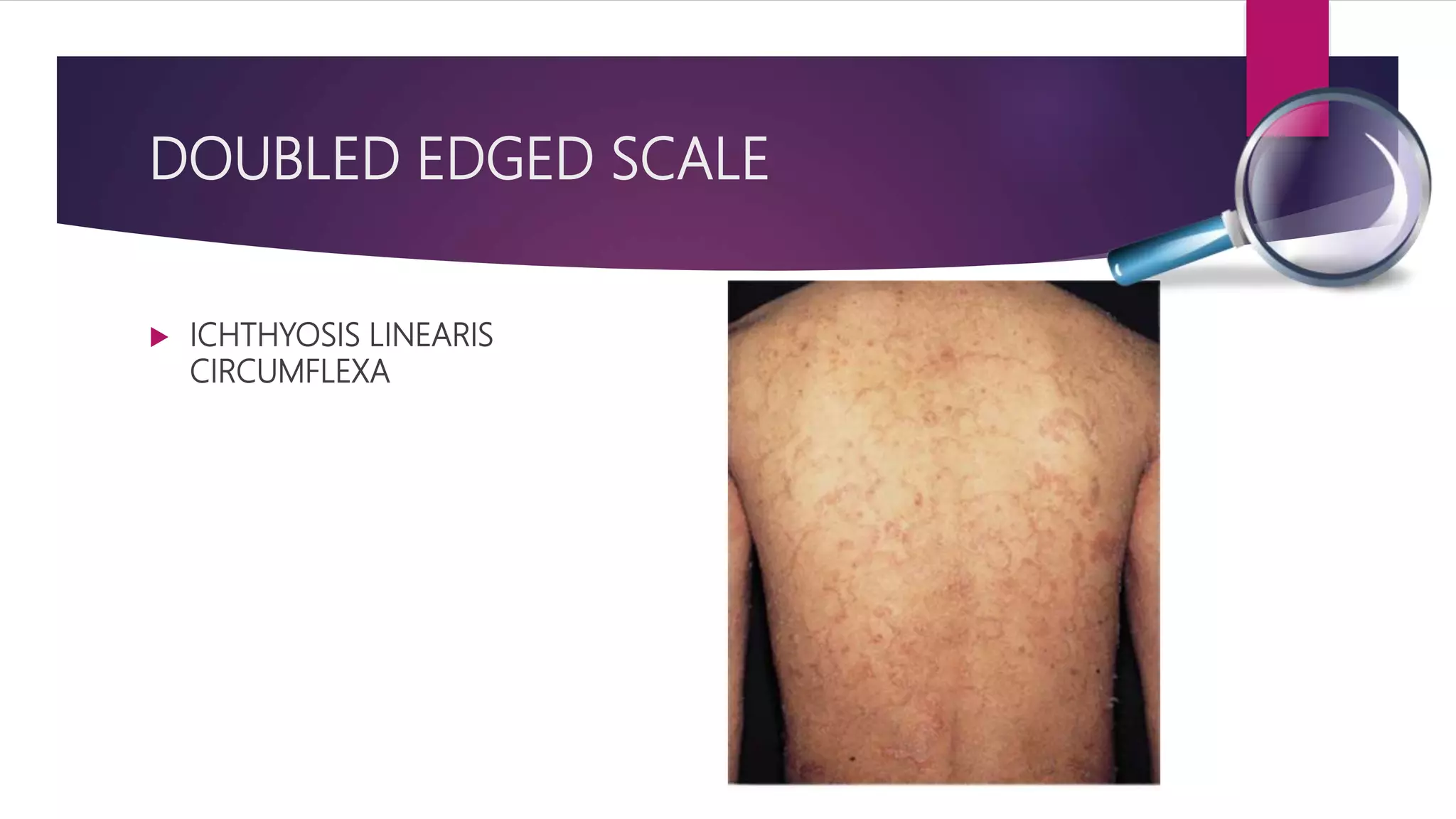 Types of scales.pptx
