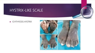 Types of scales.pptx