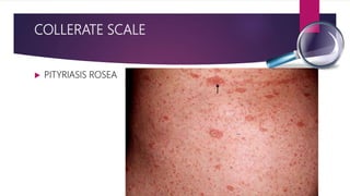 Types of scales.pptx