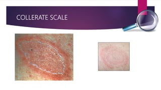 Types of scales.pptx