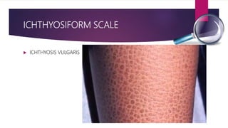 Types of scales.pptx