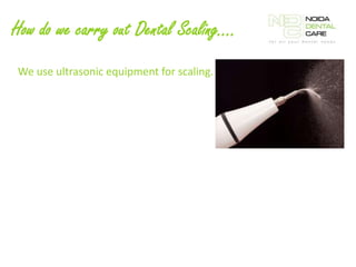 Dental Scaling - Procedure Explained | PPTX