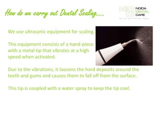 Dental Scaling - Procedure Explained | PPTX