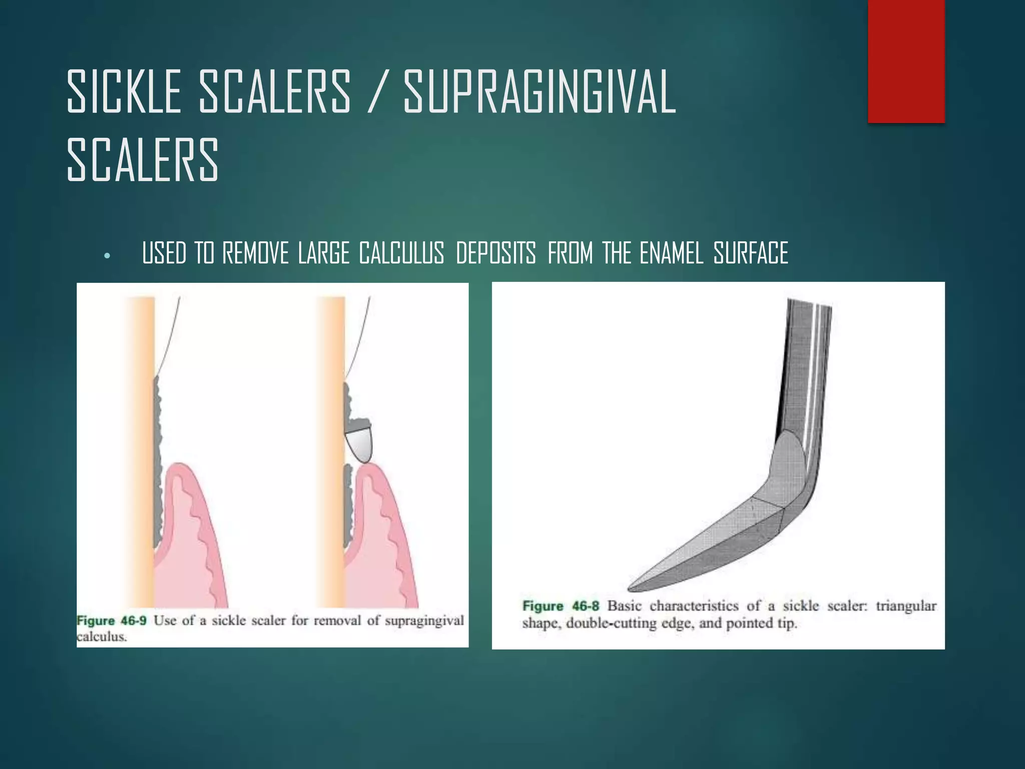 scaling and root planing instruments | PDF