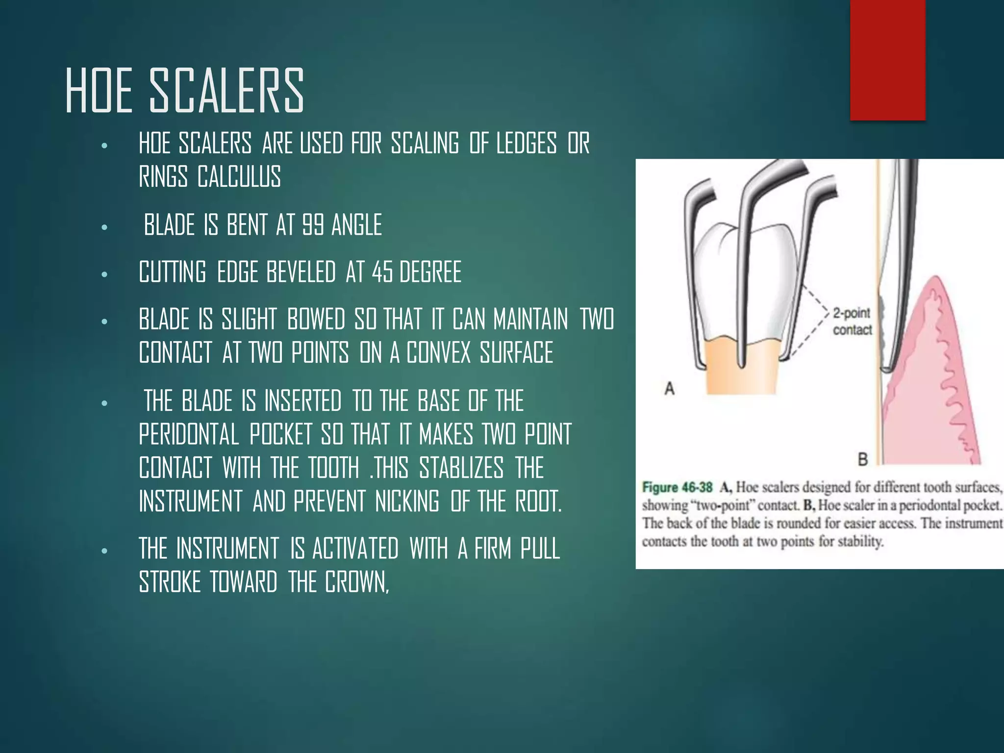 scaling and root planing instruments | PDF