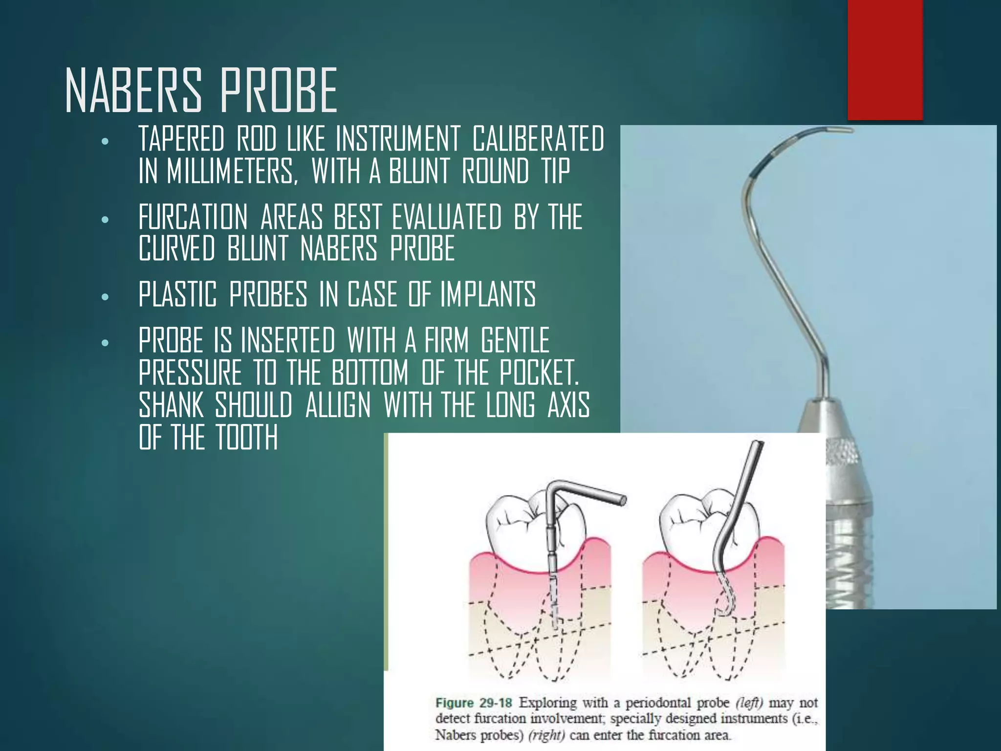 scaling and root planing instruments | PDF