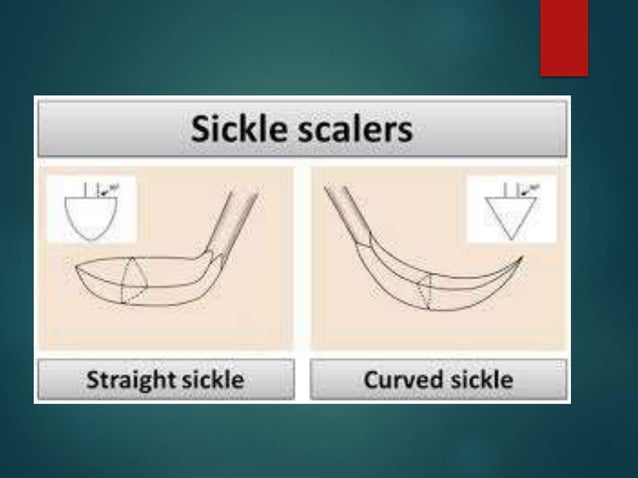 scaling and root planing instruments | PDF