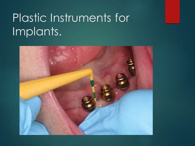scaling and root planing instruments | PDF