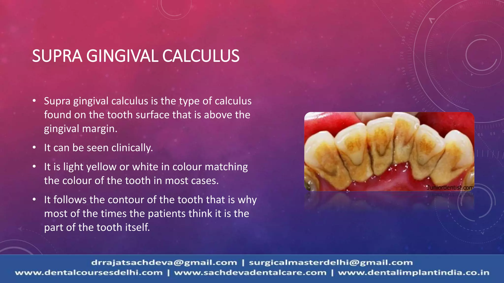 Scaling and root planning | Periodontal treatment protocol | Treatment ...