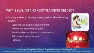 Scaling and root planning | Periodontal treatment protocol | Treatment ...