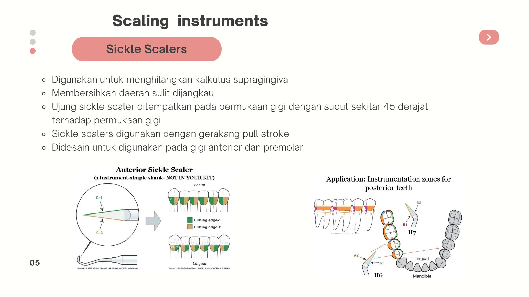 Scalling dan root planning.presentation. | PPTX