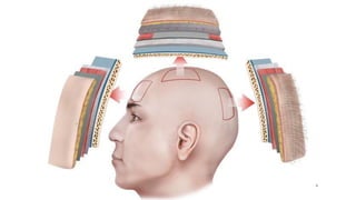 Scalp.pdf all the information...layers of scalp | PPT