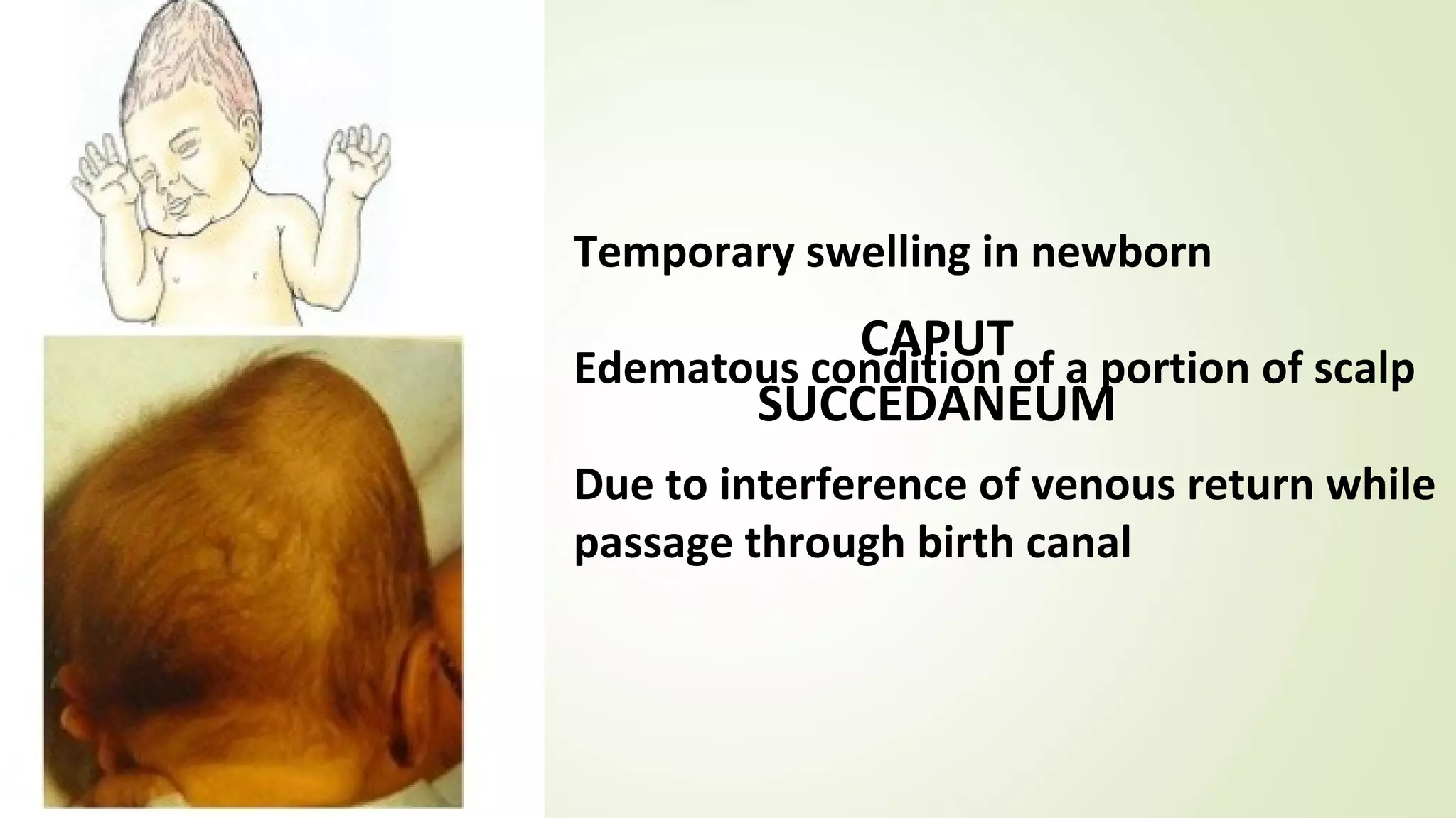 Scalp Anatomy by Dr Zobayer Mahmud Khan | PPT