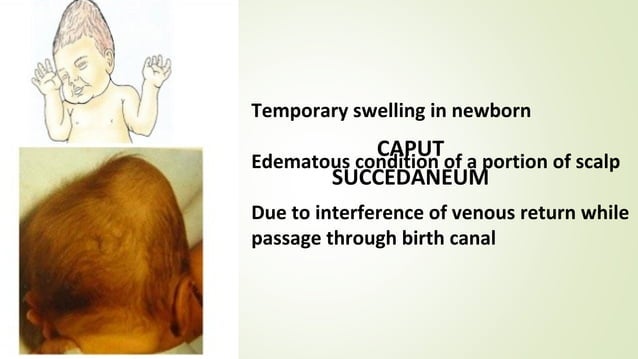 Scalp Anatomy by Dr Zobayer Mahmud Khan | PPT